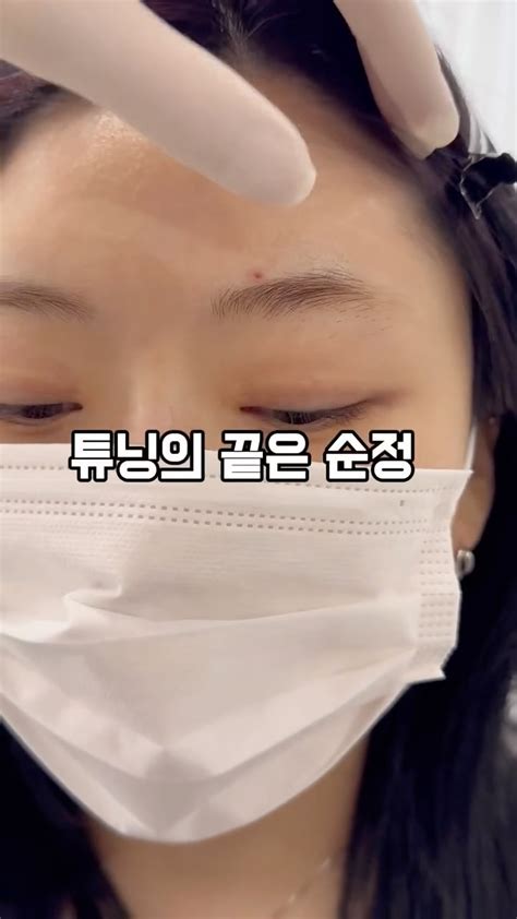 뷰티해온 강남눈썹문신 잔흔제거 눈썹문신제거 眉毛アート除去 잔흔제거수강 고객님 왈 튜닝의 끝은 순정이에요 해온에서는 순정눈썹 가능합니다🪄 잔흔제거붉은눈썹제거