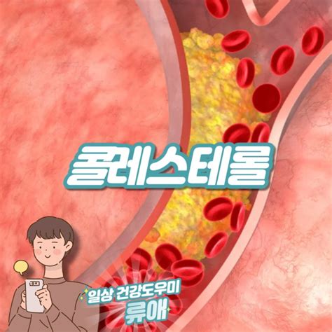 콜레스테롤 높은 이유 및 Hdl 콜레스테롤 Vs Ldl 콜레스테롤 뜻과 차이 정상 수치 네이버 블로그