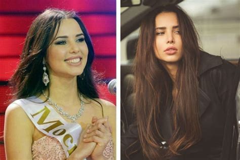 Анастасия Решетова — модель до и после пластики Фото Умница Красавица