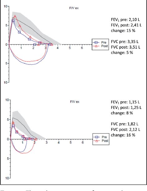 Table 1 From Flow And Volume Response To Bronchodilator In Patients