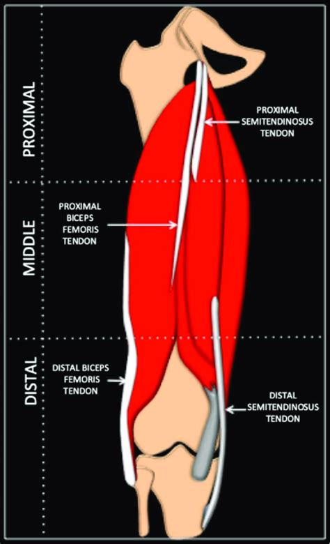 Proximal Hamstring Tendinopathy In Runners How To Fix It