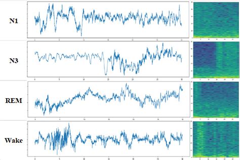 figure 1 from a deep learning method approach for sleep stage