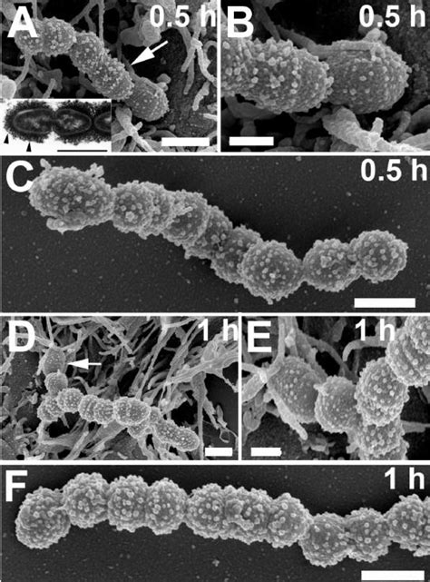 Illustration Of Pneumococcal Polysaccharide Capsule During Adherence