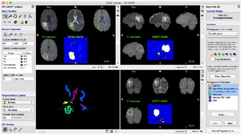 User Guided Segmentation Of Multi Modality Medical Imaging Datasets
