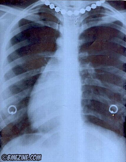 Print Photos View Full Size Image