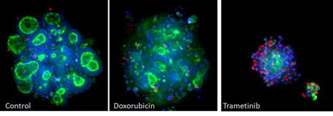assay ready patient derived organoids pdos and high throughput 3d