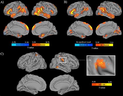 Voxel Wise Analyses Showing Differences Of Activation During The