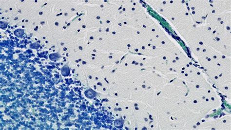 Cerebellum Cross Section Ganglionic Layer Cross Section Flickr