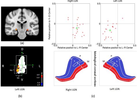 Lgn Definition And Spatial Analysis Of Top 20 Activated Voxels In Lgn