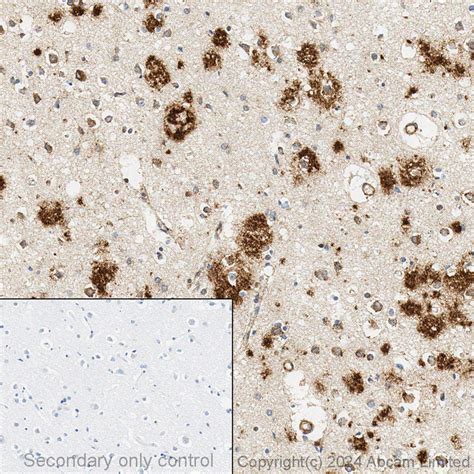 Amyloid Precursor Protein抗体 Ab2084 Abcam中文官网
