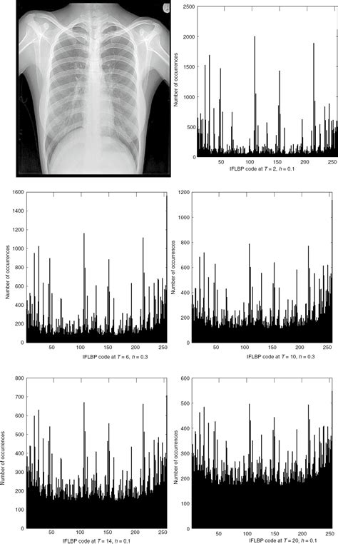 Texture Feature Extraction Using Intuitionistic Fuzzy Local Binary Pattern