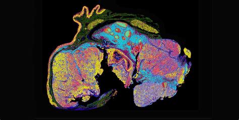 The Role Of Spatial Biology In Immunotherapy And Cancer Treatment