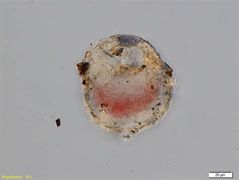 Filecollection Penard Mhng Specimen 212 7 3 Difflugia Constricatatif