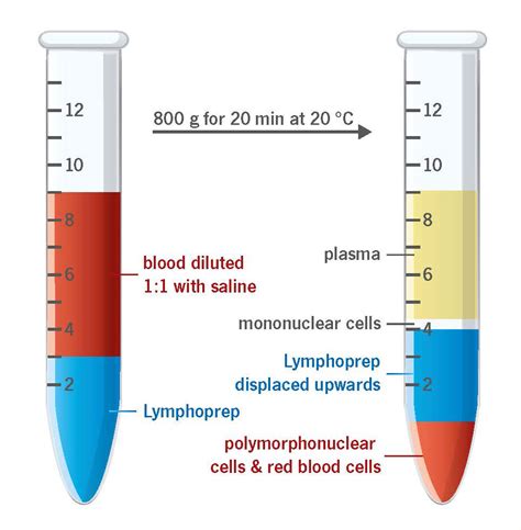Lymphoprep Density Gradient Media