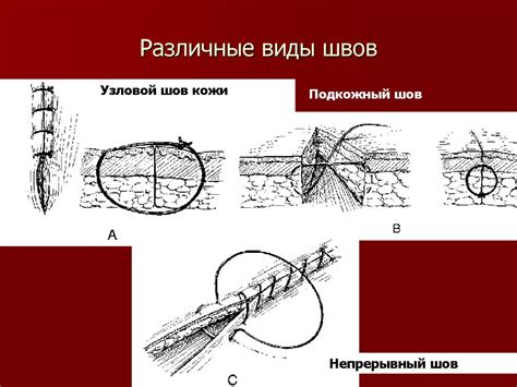 Классификация хирургических инструментов правила пользования Принципы и техника разъединения и