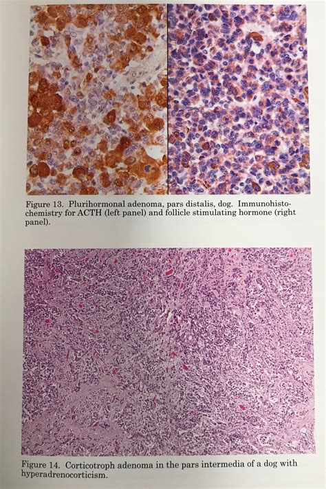 international histological classification volume xii