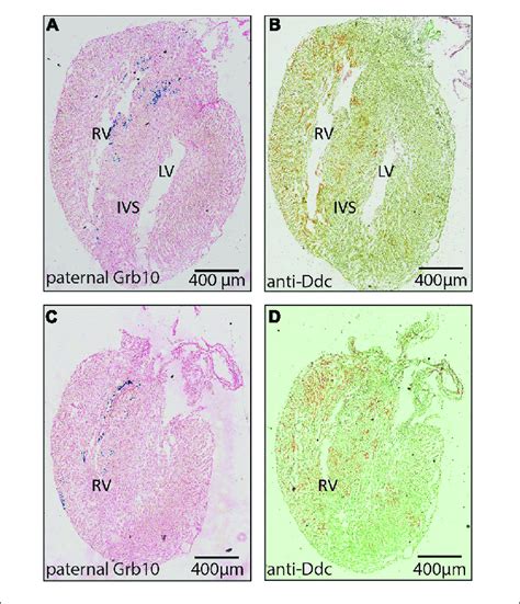 Analysis Of Paternal Grb10 Expression And Ddc Protein Staining In