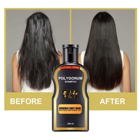 Polygonum Multiflorum Black Hair Growth Anti White Hair Shampoo Prevent White Hair Restore