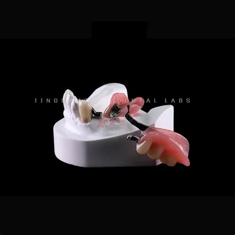 Dental Magnetic Attachment Precision Attachments Removable Partial Denture Without Clasp