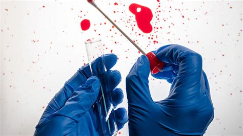 ¿que Es La SerologÍa Forense