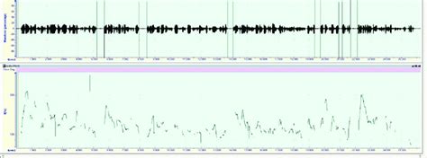 Oscillogram And Tonogram Of Spoken Not Spontaneous Discourse Download Scientific Diagram