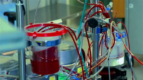 50 Bypass Machine Stock Videos Footage And 4k Video Clips Getty Images