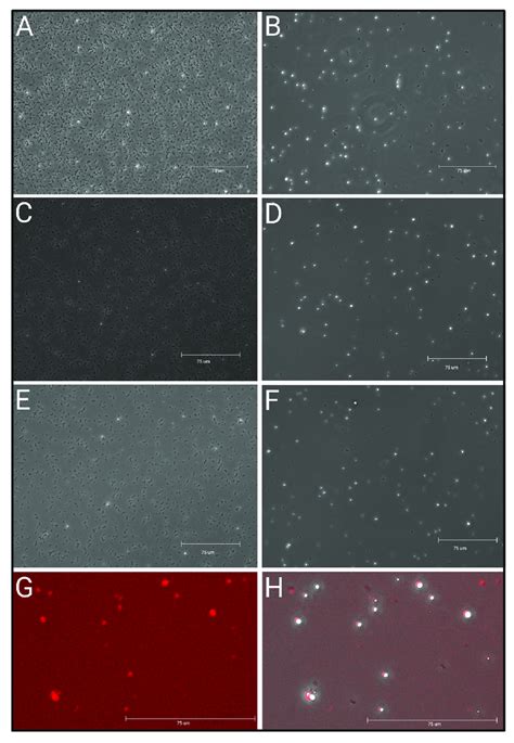 Nuclei Observed Under The Microscope Before And After Bacterial Clean Download Scientific