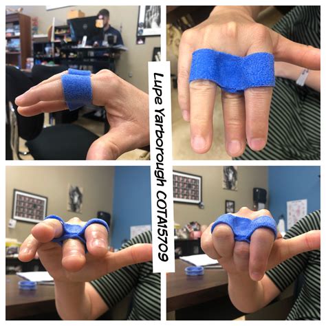 Rehabilitation After Distal Humerus Fractures Artofit