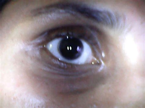 1402 Iris Detection Ninad`s Research Lab