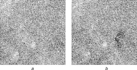 Superpixels Of The Ier A Forward Phase B Post Phase Download