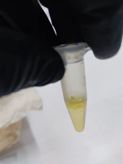 What Is The Best Way To Precipitate Protein After Ultracentrifugation In Optiprep Gradient