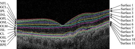 An Example Of Eleven Layer Segmentation The Level Scale And Download Scientific Diagram