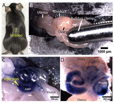 Somatic Genome Engineered Mouse Models Using In Vivo Microinjection And Electroporation Text Page