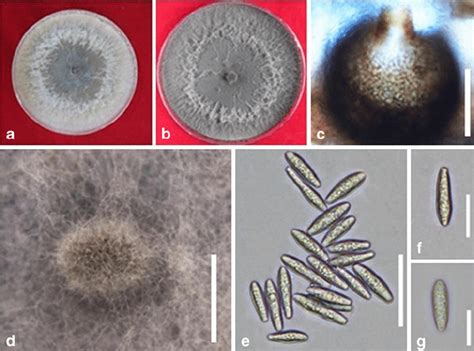 Fig 4 Botryosphaeria Dothidea Bjs 01 S A Young Colony On Pda 7