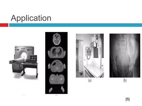 Presentation On Deformable Model For Medical Image Segmentation Ppt Photo Editing Software