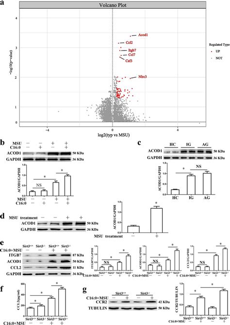 Sirt3 Deficiency Resulted In Further Up Regulation Of Acod1 Expression Download Scientific