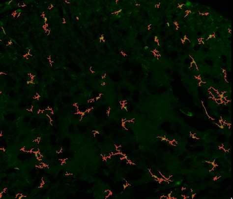 How To Use The Microglia Analyzer” Widget — Microglia Analyzer 001 Documentation
