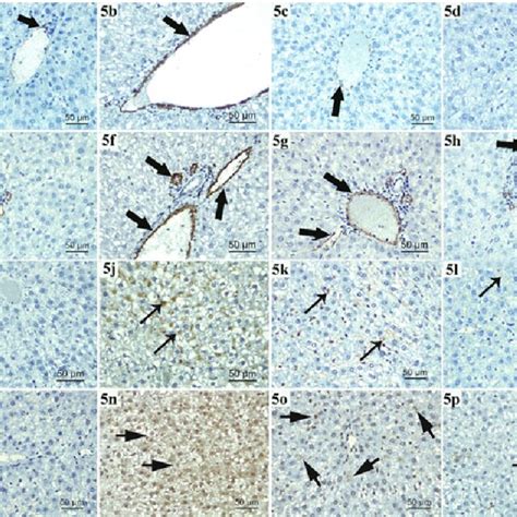 Hepatic Immunostaining For α Sma A Few α Sma Positive Cells Thick Download Scientific