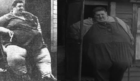 Meet The Heaviest Human Ever Recorded In Medical History
