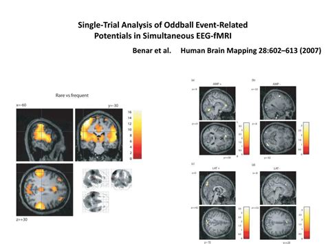 Ppt Multi Modal Imaging Simultaneous Eeg Fmri Powerpoint