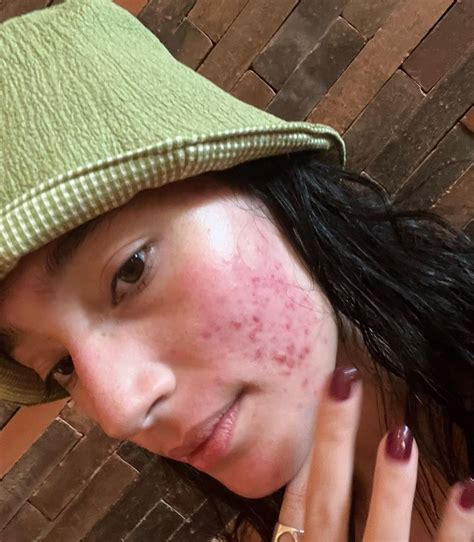 Terpopuler Sepekan Wajah Tatjana Saphira Tanpa Makeup Pd Pamer Jerawat