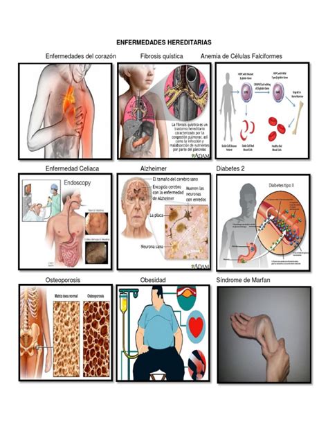 Enfermedades Hereditarias Pdf Salud Pública Enfermedades Y
