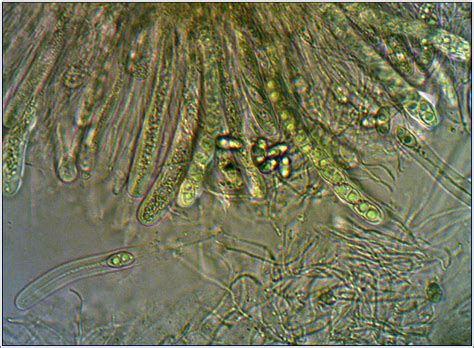 Lichen Anisomeridium Biforme
