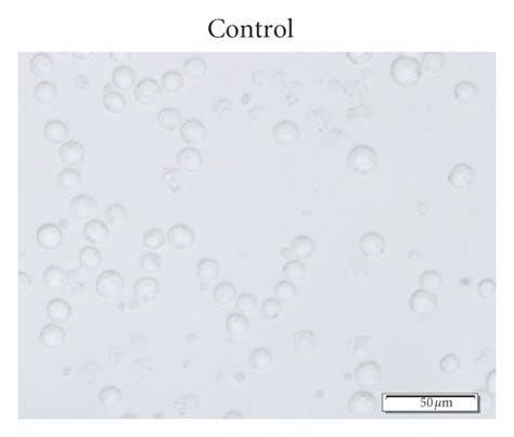 Fluorescence And Optical Detection Of Apoptosis Using Dapi Staining In
