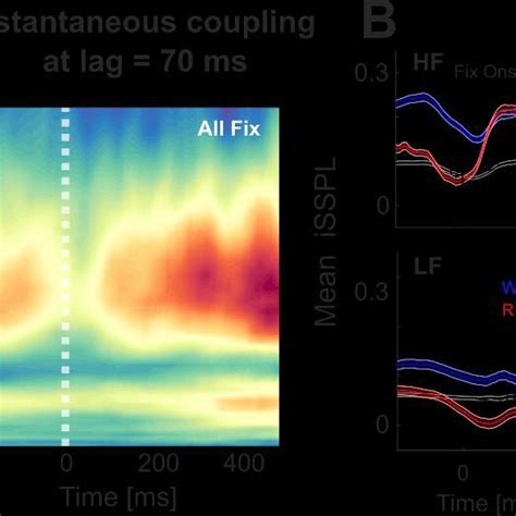 Sspl Dynamics Across The Saccade Fixation Cycle Data From A Single
