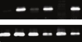 A Representative Picture Of Validation Of Microarray Result Using RT Download Scientific