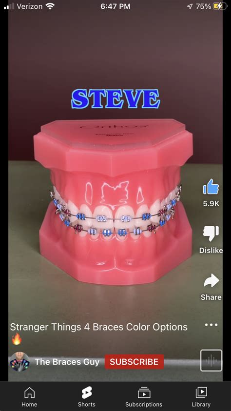 Pin By Darkskinn Queen 😍🤘🏿 On Braces Colors Braces Colors Cute