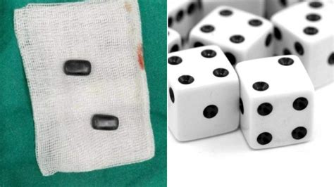 Demi Menang Judi Dadu Pria Tanam Magnet Di Jarinya Biar Bisa Curang