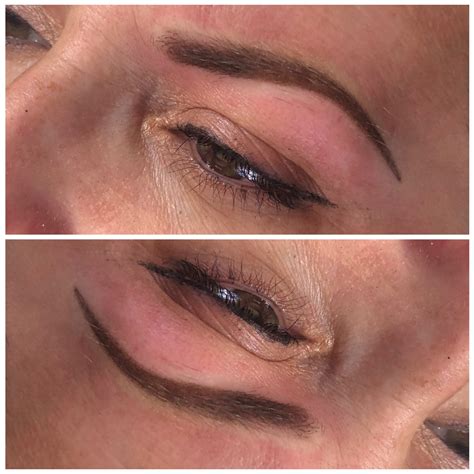 Gallery Madison Skin Specialists