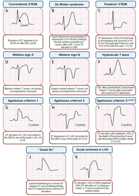 Vertigo Algorithm R Foamed911